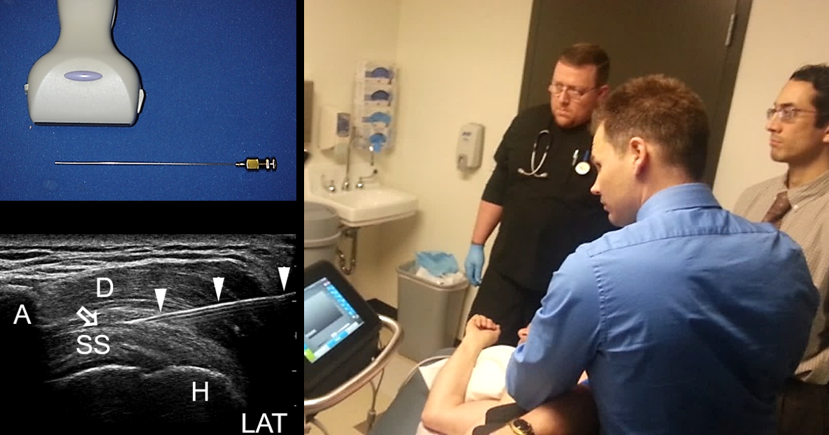 Ultrasound Guided Procedures ESPMedicine